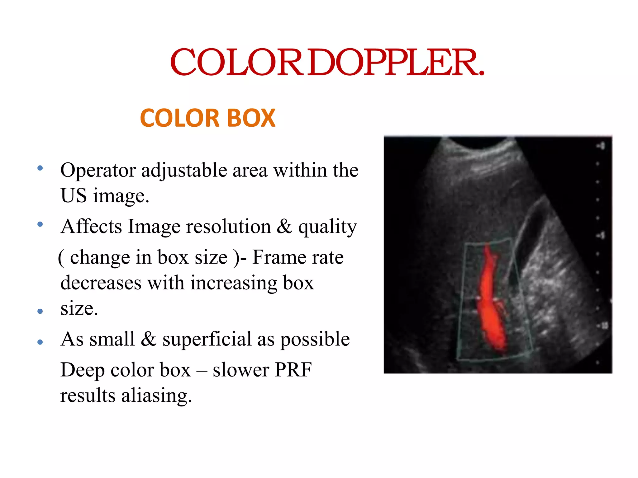 Color Doppler Ultrasound - Basic physics | PPTX