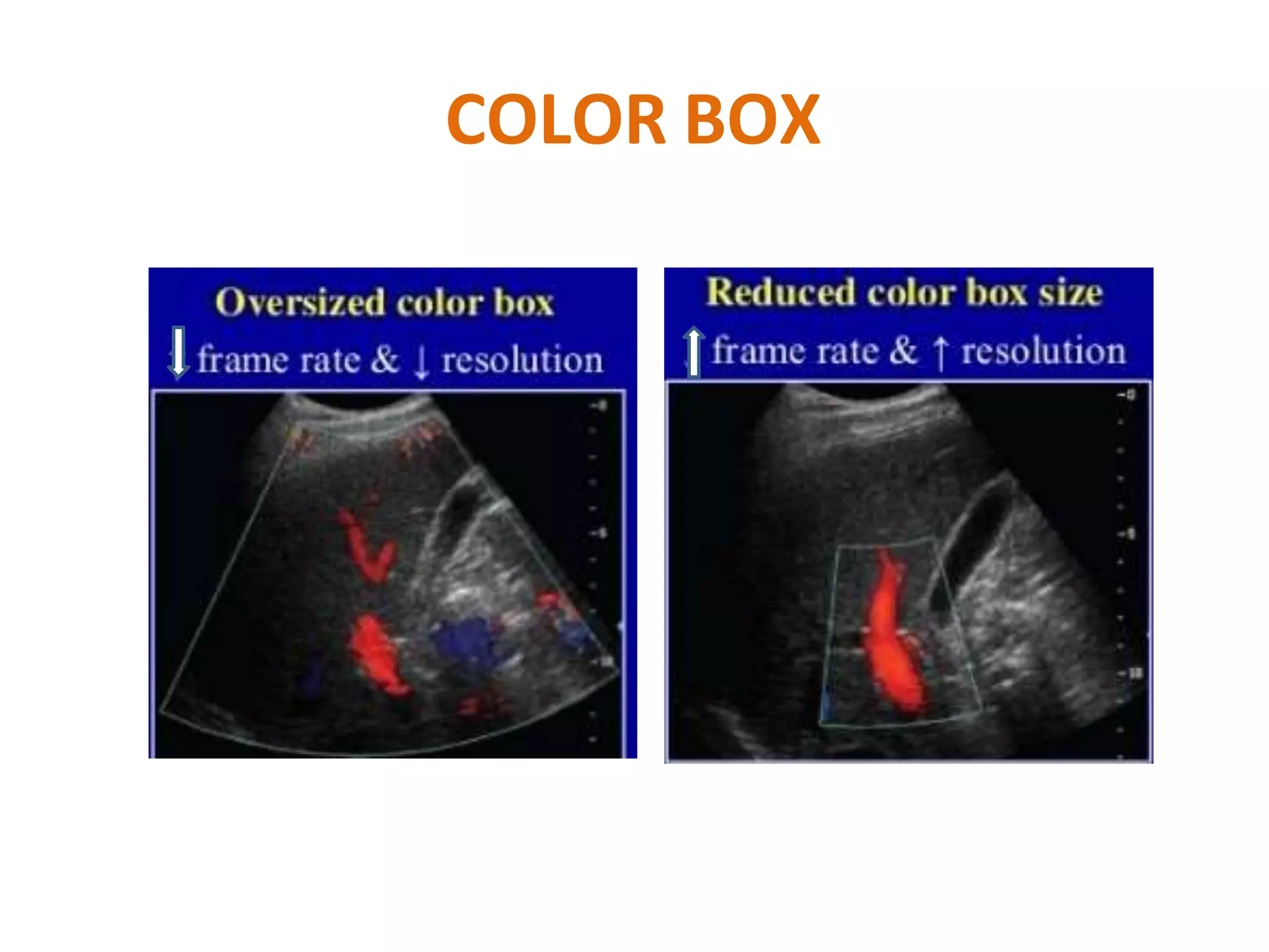 Color Doppler Ultrasound - Basic physics | PPTX