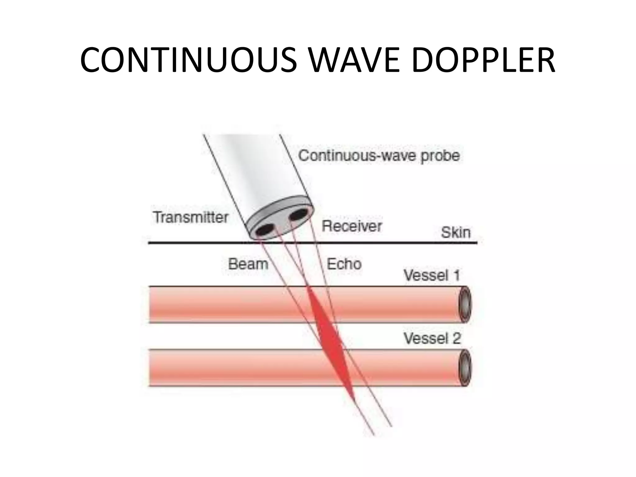 Color Doppler Ultrasound - Basic physics | PPTX