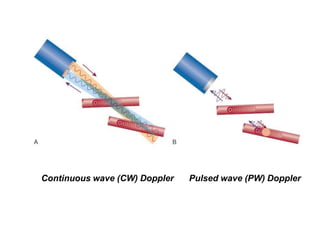 Color Doppler Ultrasound - Basic physics | PPTX