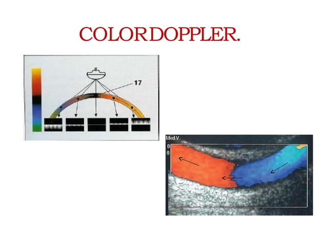 Color Doppler Ultrasound - Basic physics | PPTX | Physics | Science