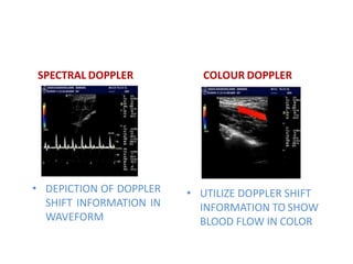 Color Doppler Ultrasound - Basic physics | PPTX | Physics | Science