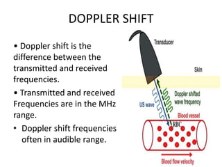 Color Doppler Ultrasound - Basic physics | PPTX | Physics | Science