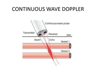 Color Doppler Ultrasound - Basic physics | PPTX