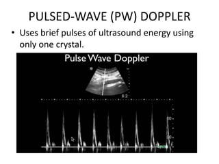 Color Doppler Ultrasound - Basic physics | PPTX