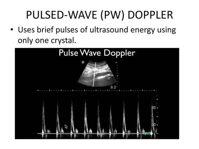 Color Doppler Ultrasound - Basic physics | PPTX | Physics | Science