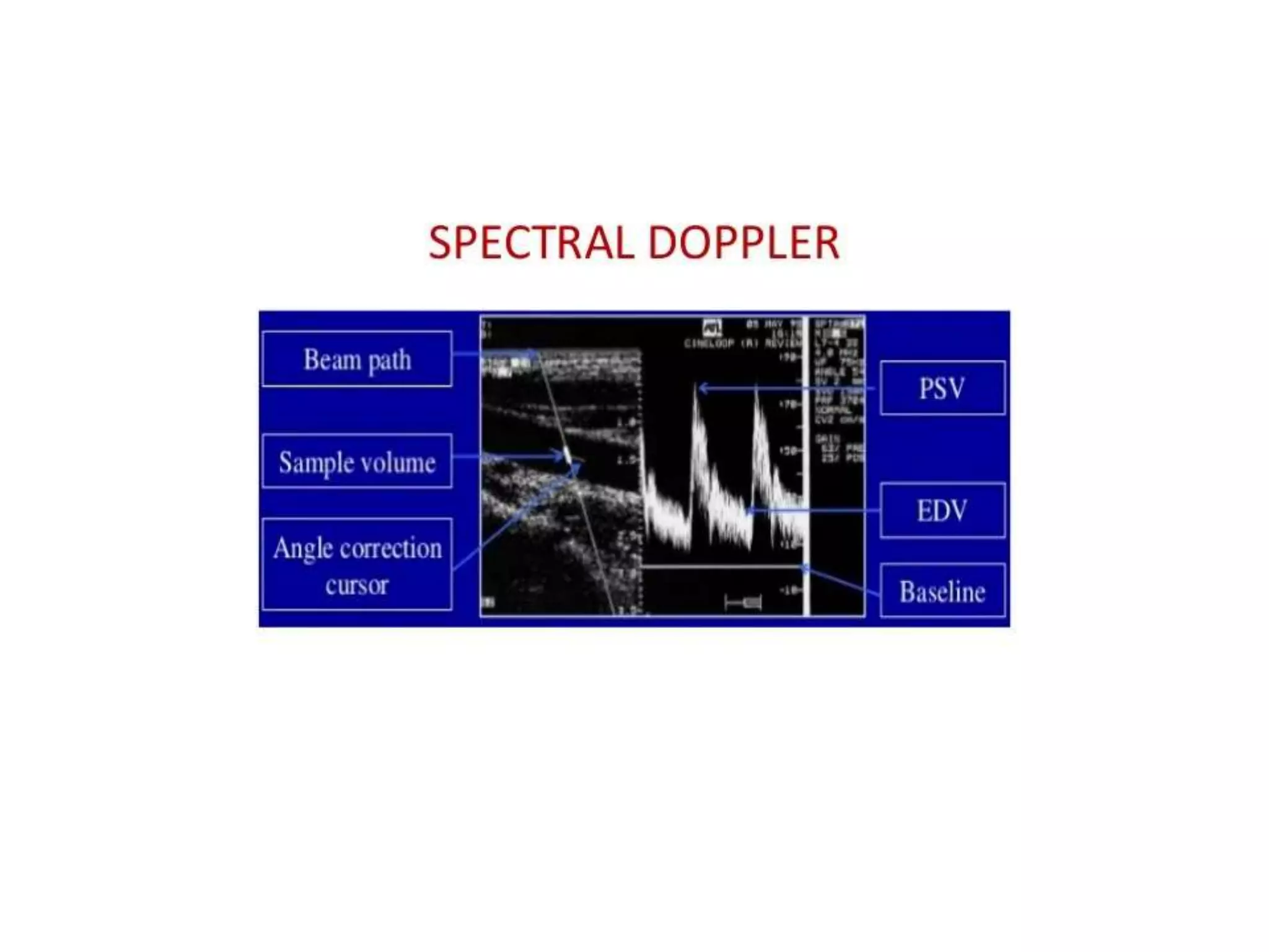 doppler physics.pptx