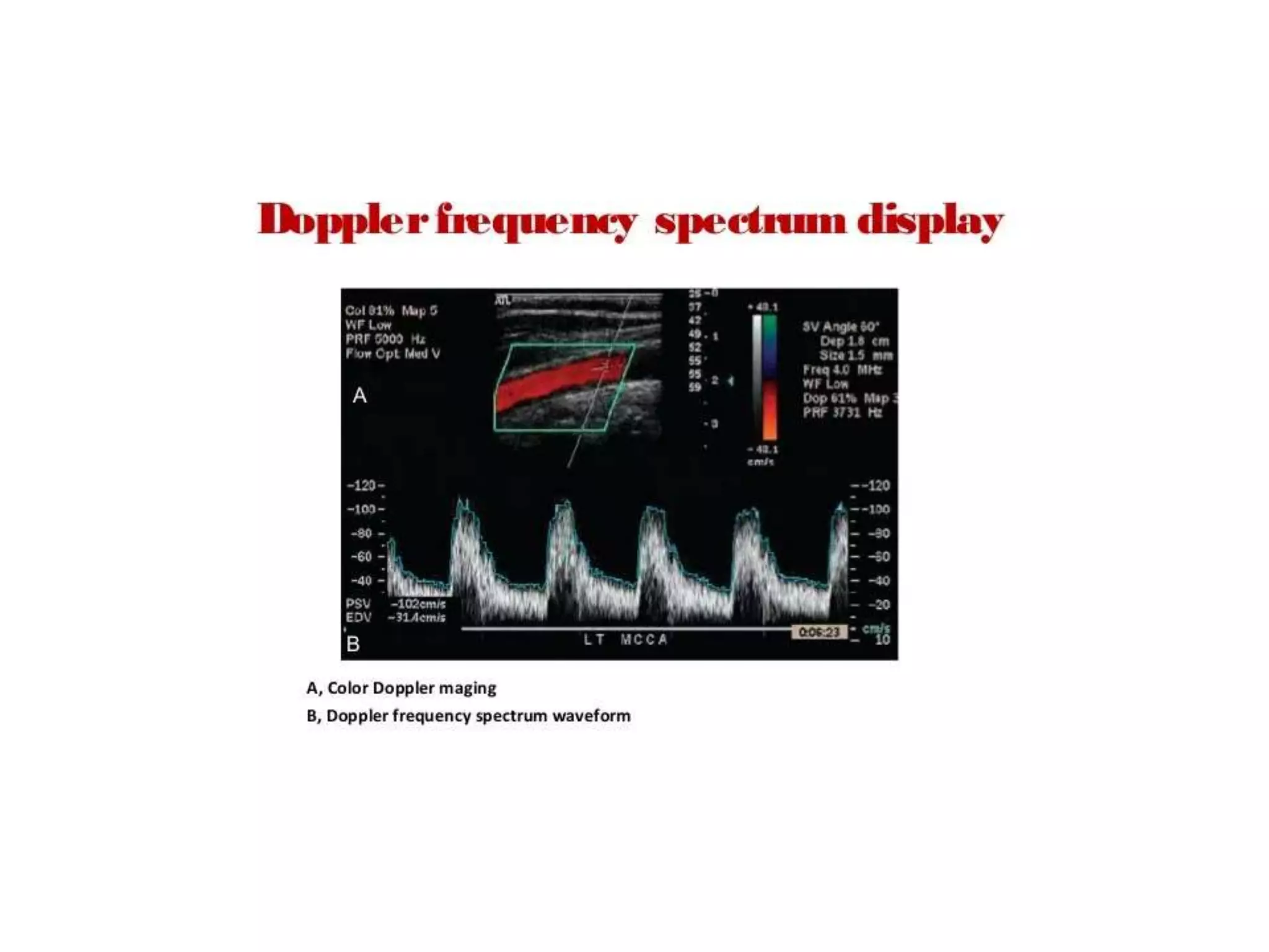 doppler physics.pptx