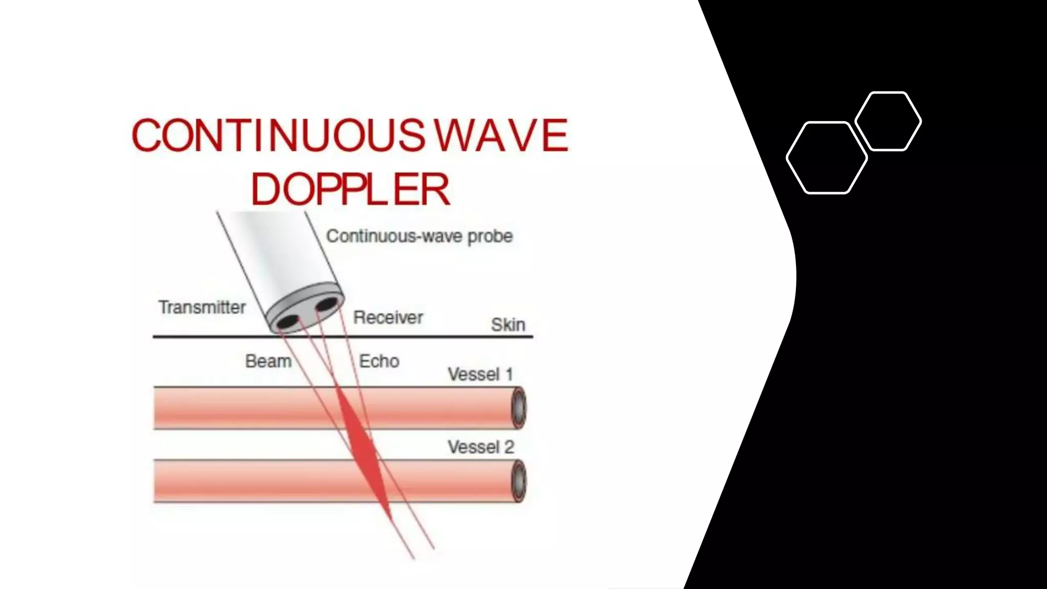 Doppler physics.pptx