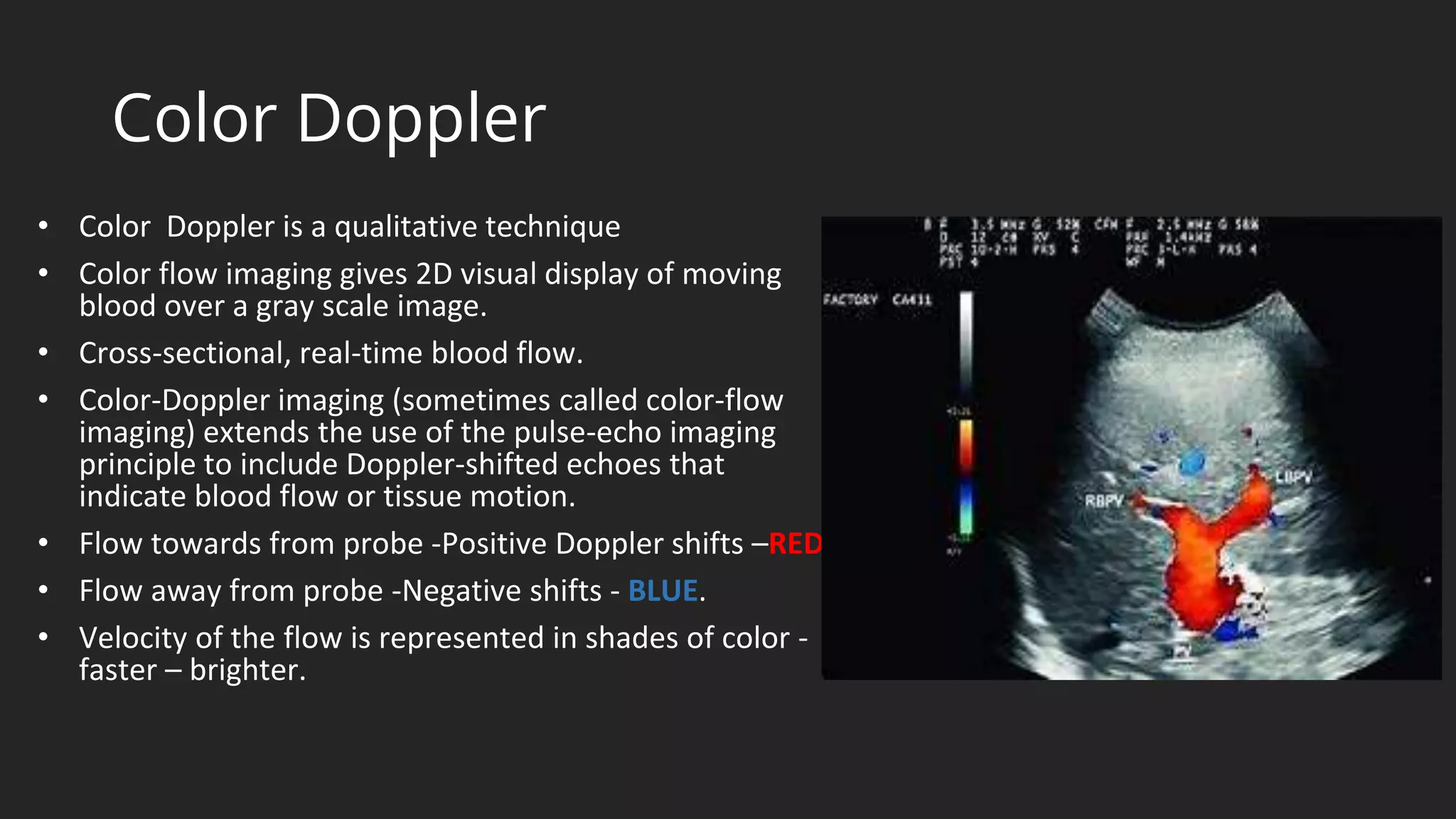 Doppler physics.pptx