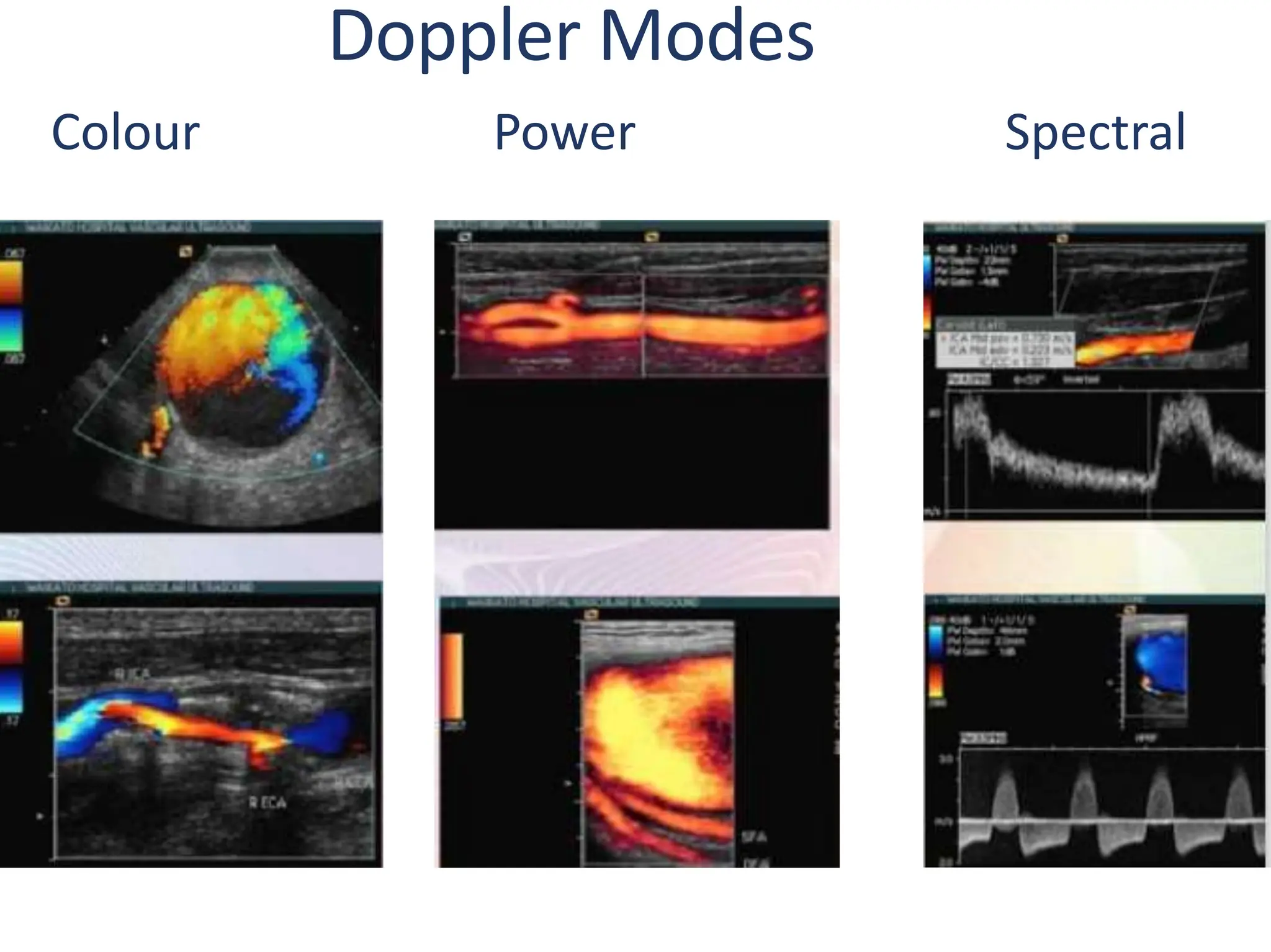dopplerphysics2.pptx