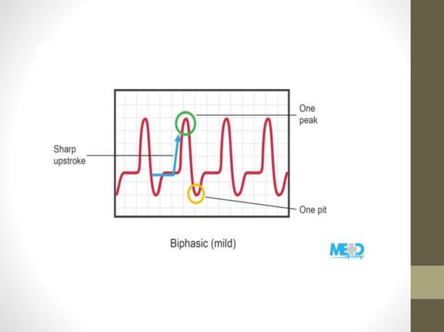Doppler Physics & instrumentation 4 | PPT