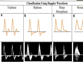 Doppler Physics & instrumentation 4 | PPTX
