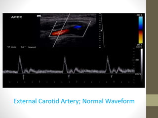 Doppler Physics & instrumentation 4 | PPTX