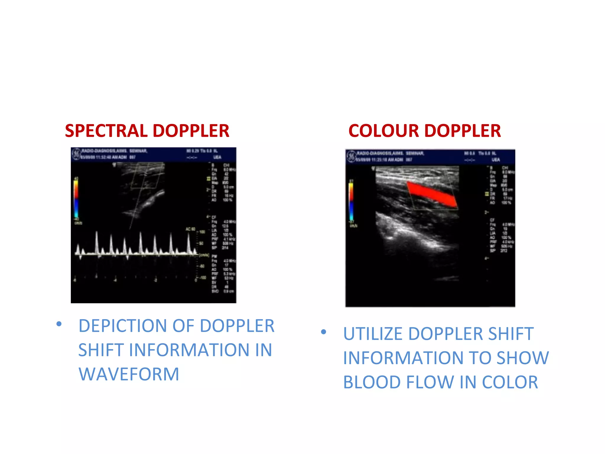 Doppler physics by Dr Nani