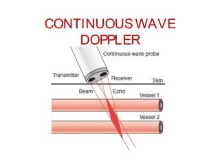 Doppler physics by Dr Nani | PPT
