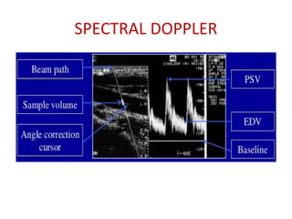 Doppler physics by Dr Nani | PPT