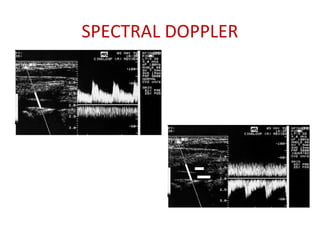 Doppler physics by Dr Nani | PPT