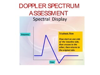Doppler physics by Dr Nani | PPT