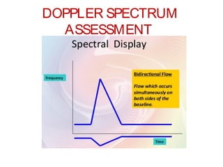 Doppler physics by Dr Nani | PPT