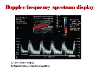 Doppler physics by Dr Nani | PPT