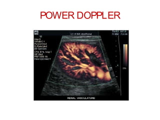 Doppler physics by Dr Nani | PPT