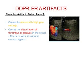 Doppler physics by Dr Nani | PPT