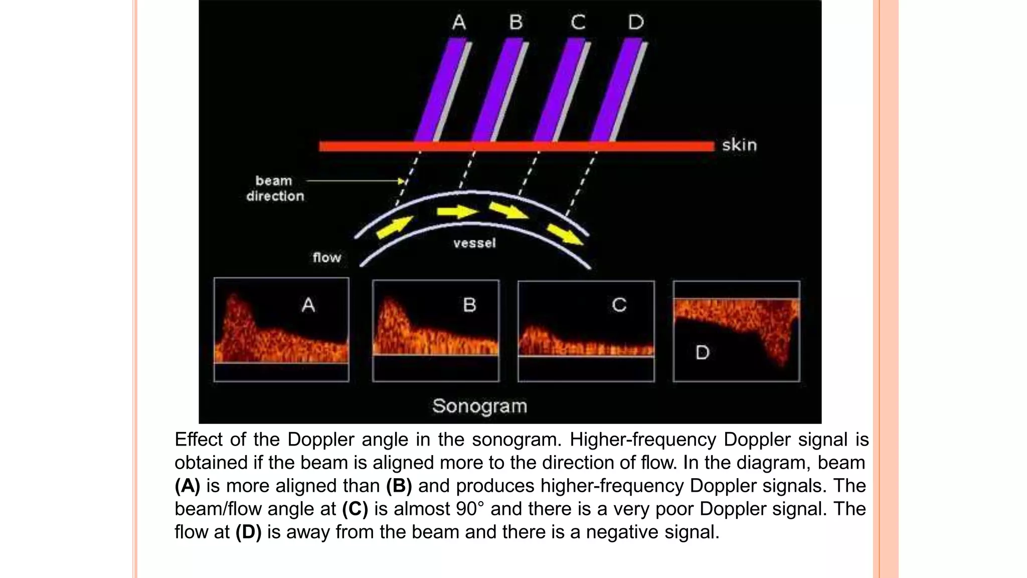 Doppler physics ppt | PPTX