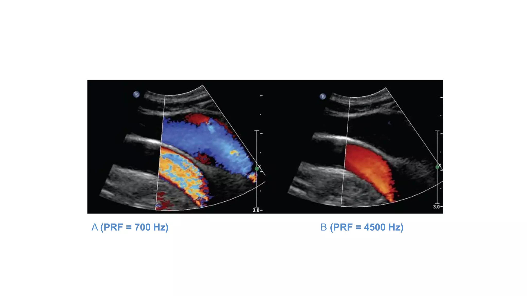 Doppler physics ppt | PPTX