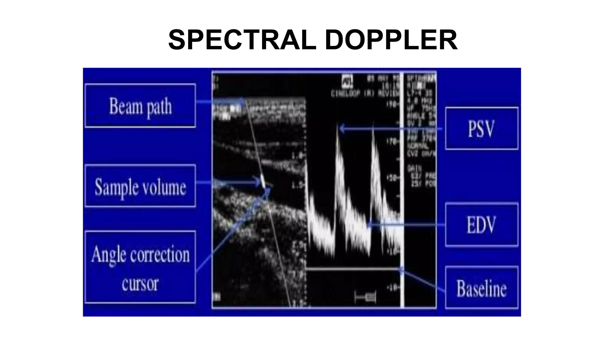 Doppler physics ppt | PPTX | Digital Audio | Computer Software and ...