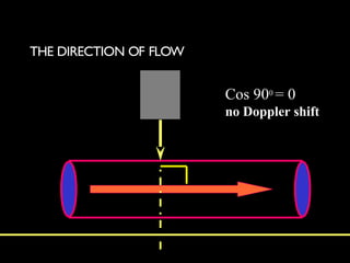 DOPPLER PHYSICS and interpretation of doppler waveform Presentation | PPTX