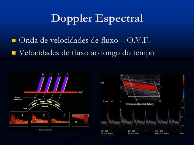 Doppler principios