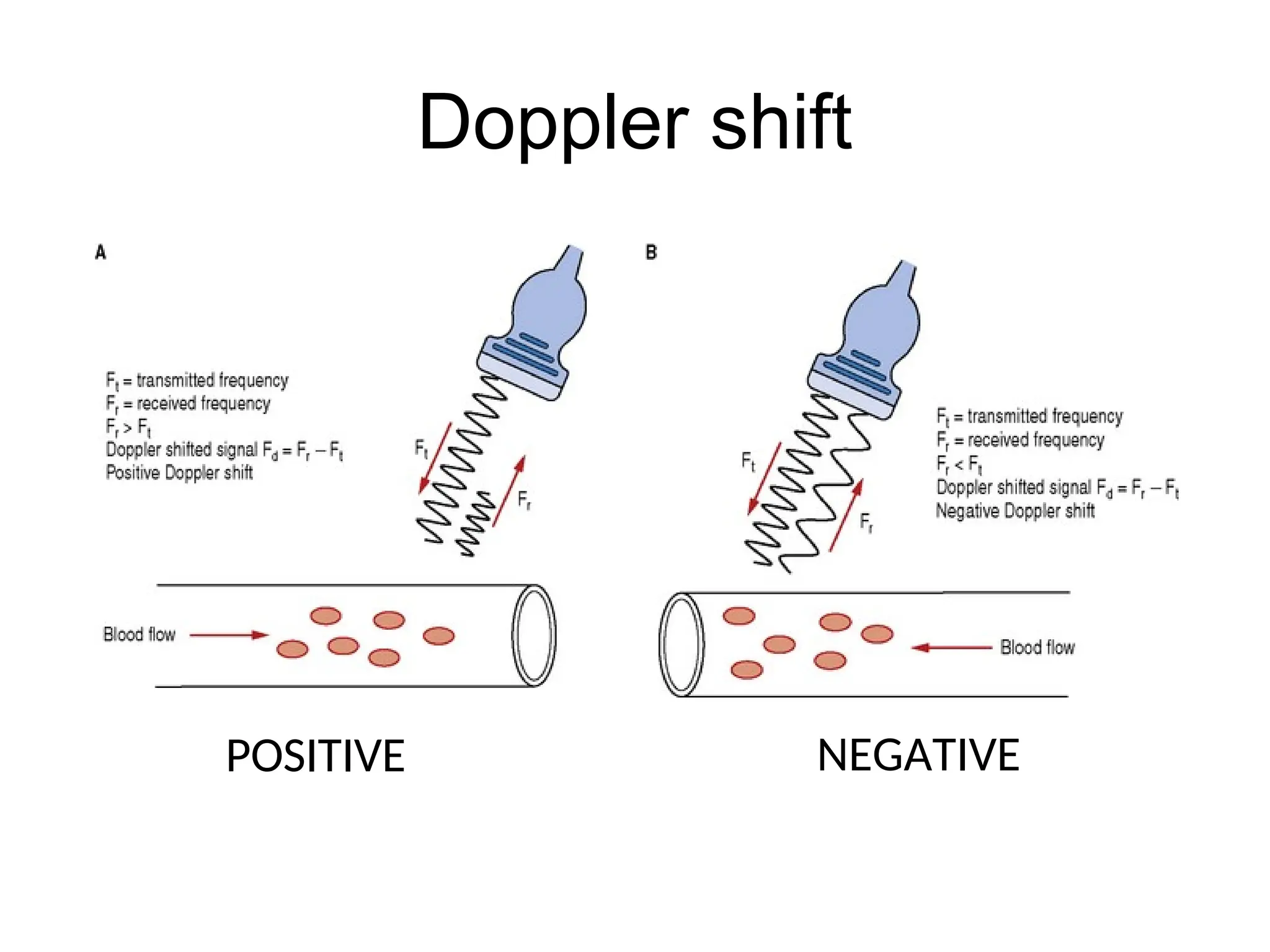 Doppler principle Evaluation of waveform .pptx
