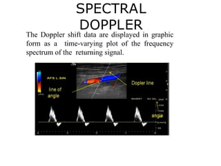 Doppler principle Evaluation of waveform .pptx
