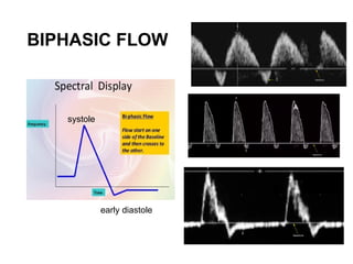 Doppler principle Evaluation of waveform .pptx