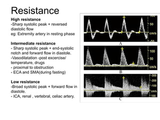 Doppler principle Evaluation of waveform .pptx