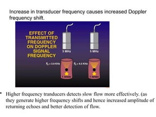 Doppler principle Evaluation of waveform .pptx