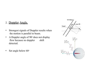Doppler principle Evaluation of waveform .pptx