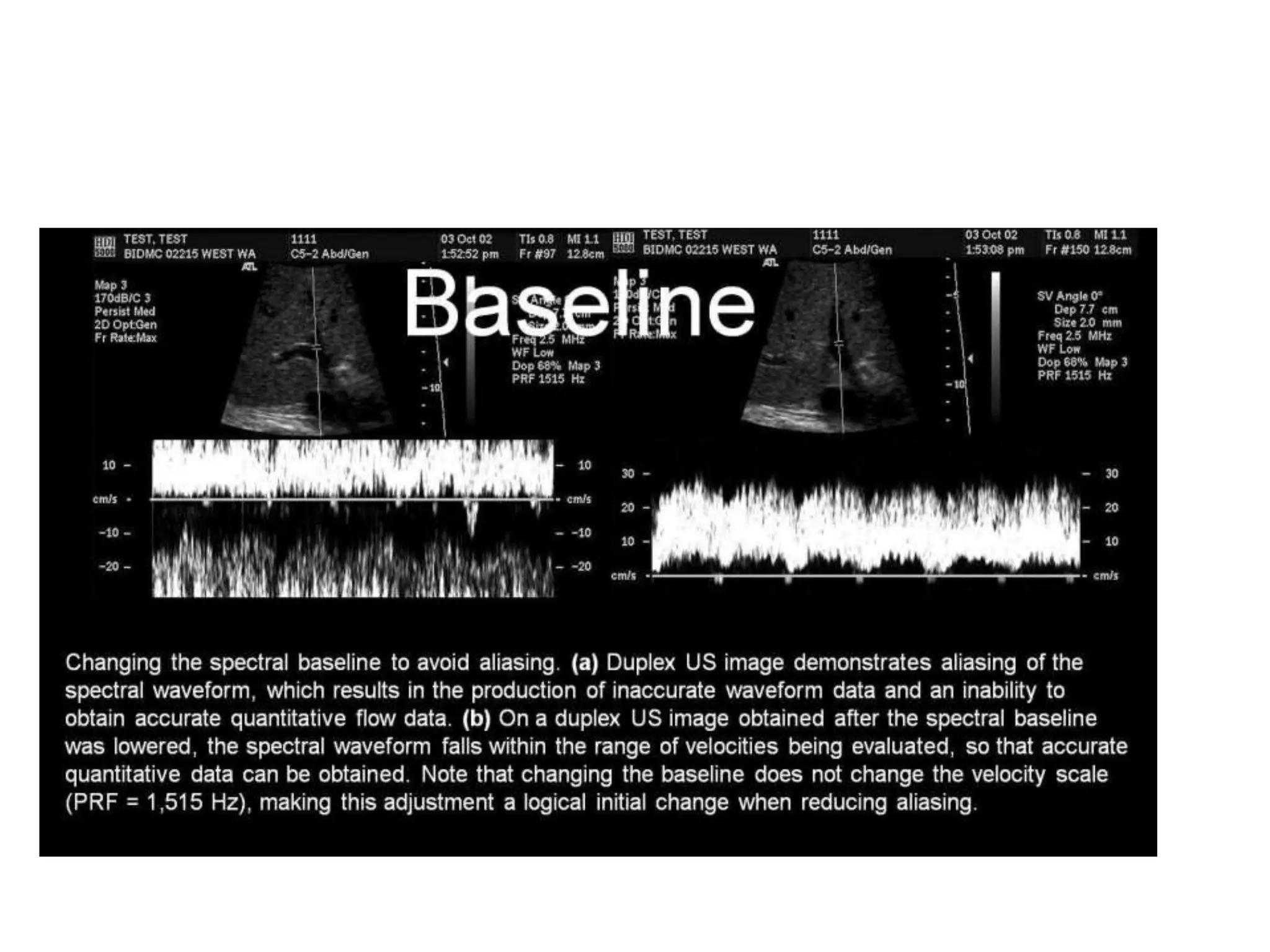 Doppler principles [1] | PPTX