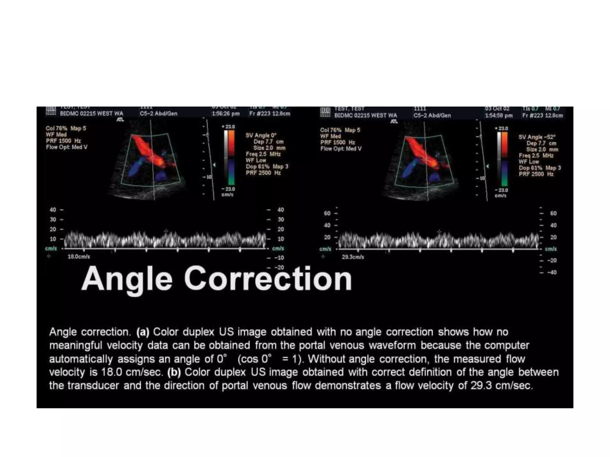 Doppler principles [1] | PPTX