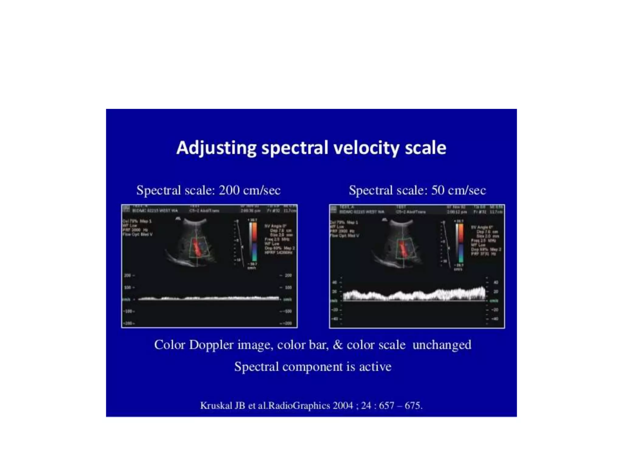 Doppler principles [1] | PPTX