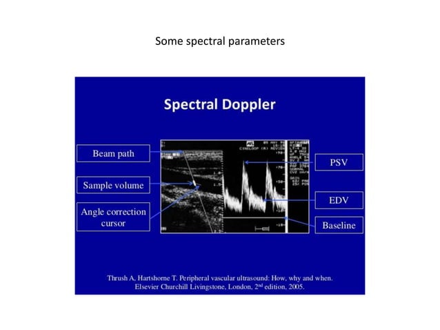 Doppler principles [1] | PPTX | Digital Audio | Computer Software and ...