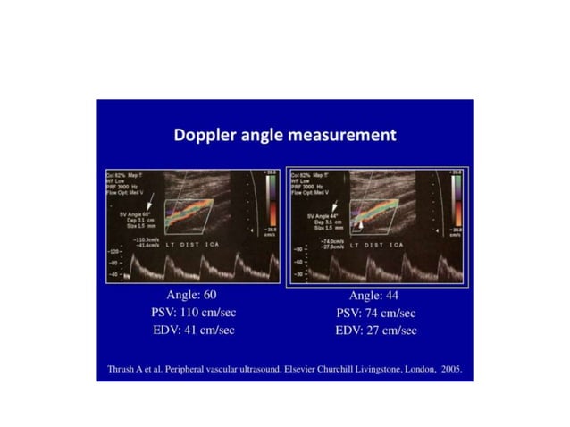 Doppler principles [1] | PPTX | Digital Audio | Computer Software and ...