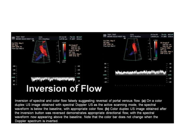 Doppler principles [2] | PPT