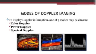 Doppler Sonography: Principles and Artifacts | PPTX