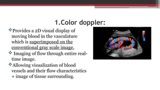 Doppler Sonography: Principles and Artifacts | PPTX