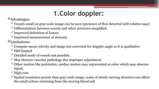 Doppler Sonography: Principles and Artifacts | PPTX