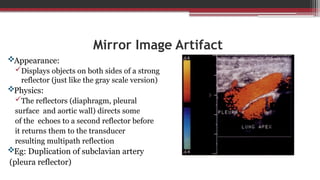 Doppler Sonography: Principles and Artifacts | PPTX