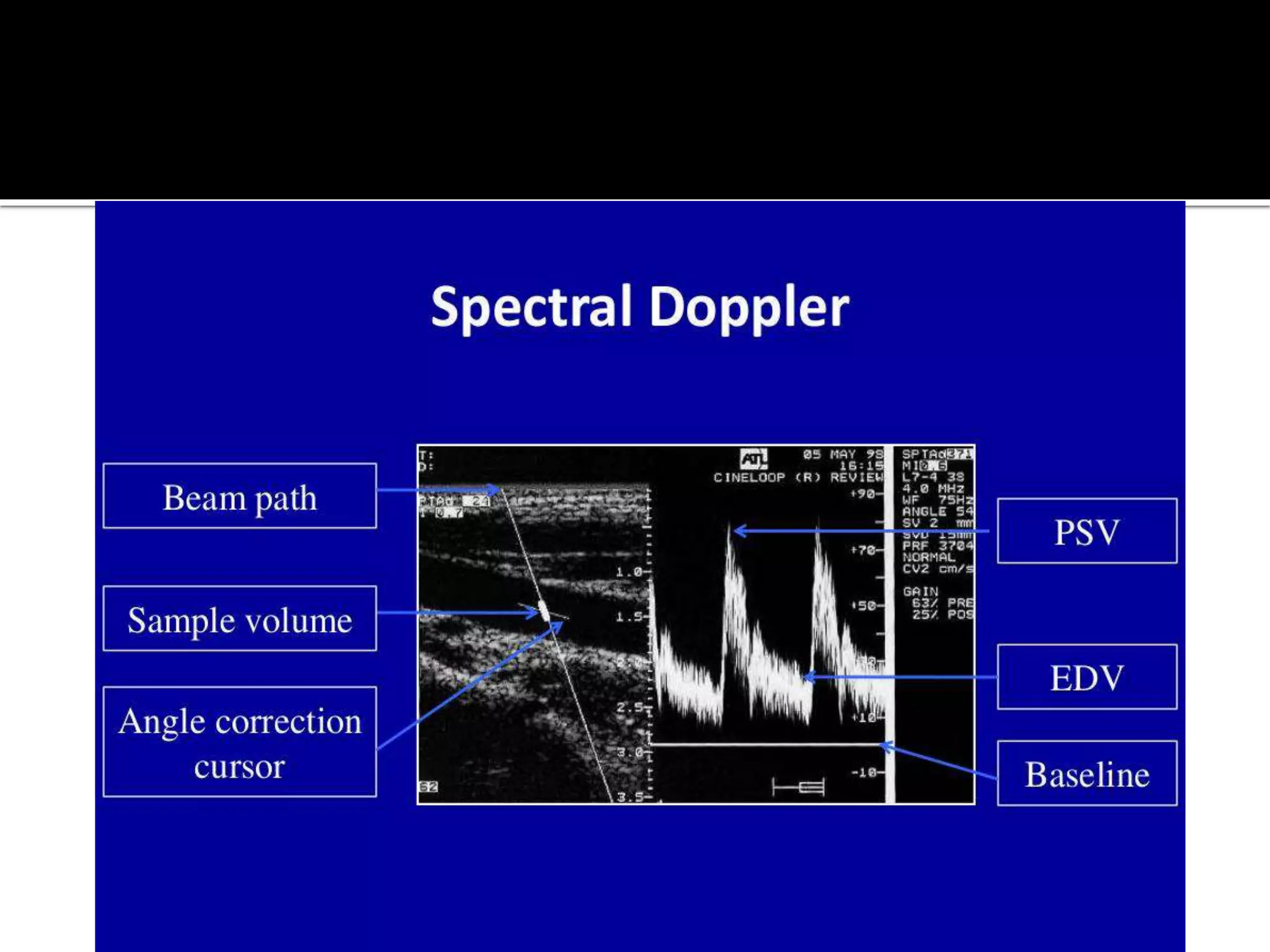 Doppler study general bases | PPT