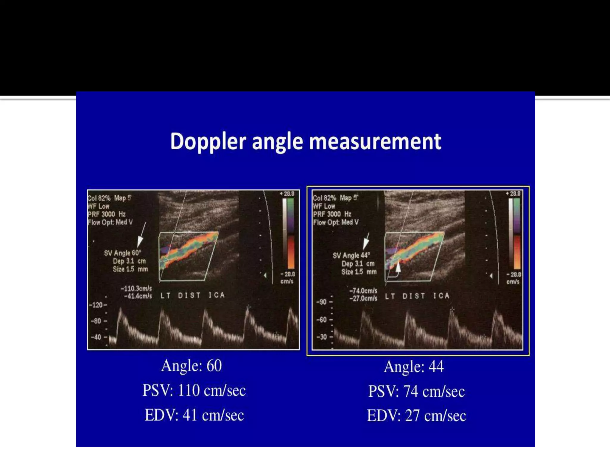 Doppler study general bases | PPT